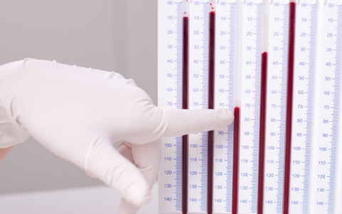 What might be the reasons for a high ESR level?