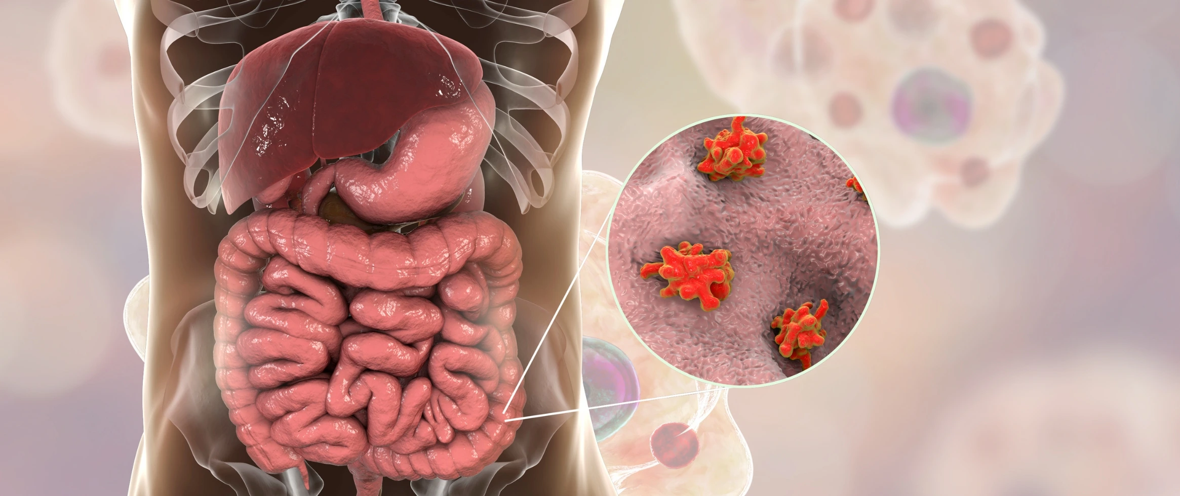 Amebiasis (Amoebic Dysentery): Signs, Symptoms & How It’s Treated