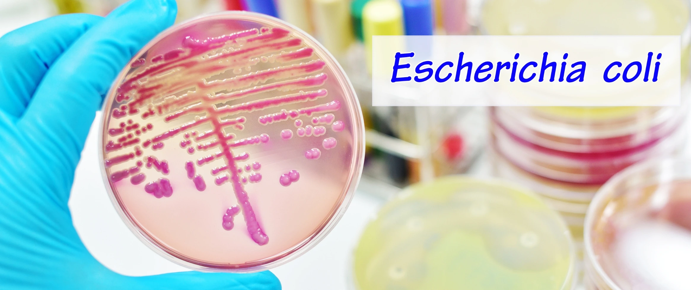 E. coli Infection: Causes, Symptoms, and How It’s Treated