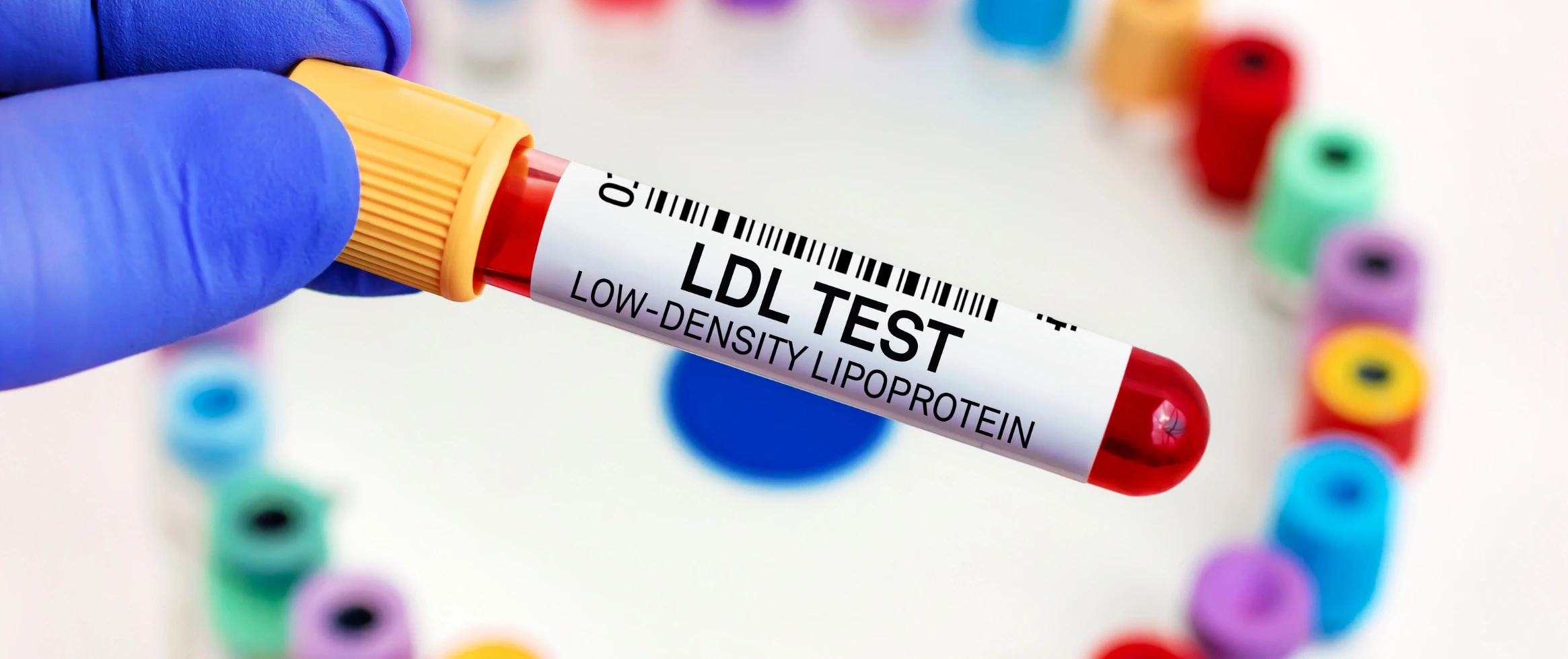 LDL Cholesterol: What It Is & How to Manage It