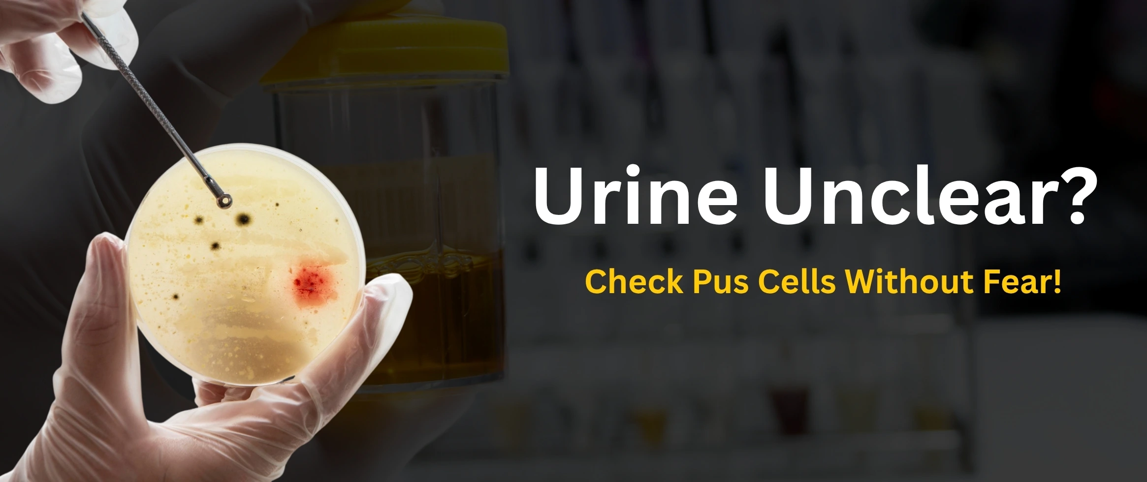 Pus Cells in Urine: What Causes It & How It’s Diagnosed