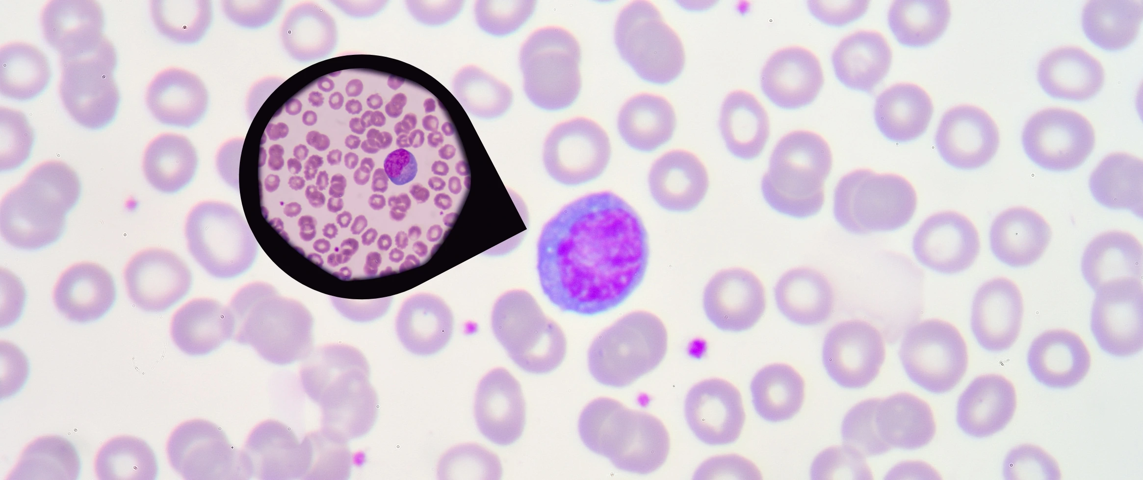 Understanding Lymphocytes: What They Do and What Your Levels Mean